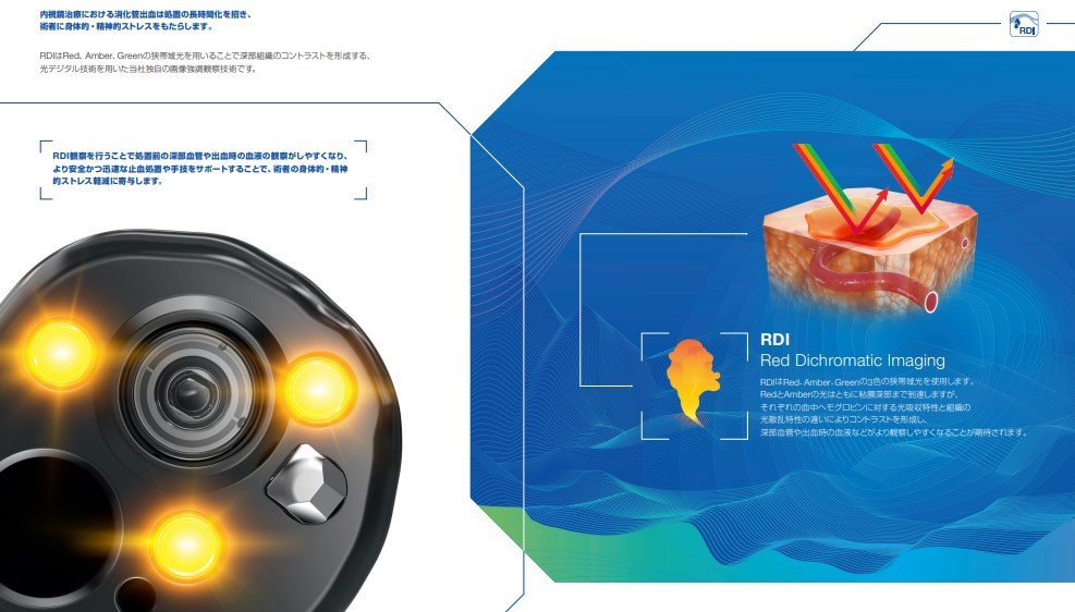 品川区・目黒区で無痛胃カメラ（胃内視鏡検査）なら、おおさわ胃腸肛門クリニック